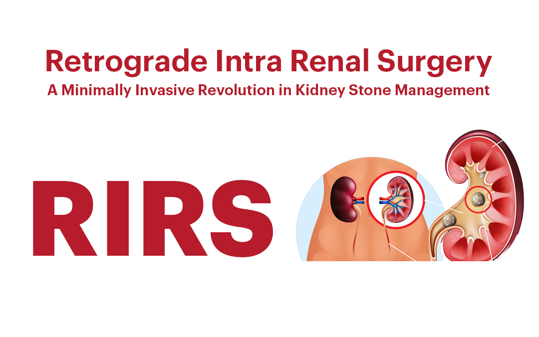 RIRS full form | RIRS in Urology: Full Form & Benefits - Dr Zubair Cheema